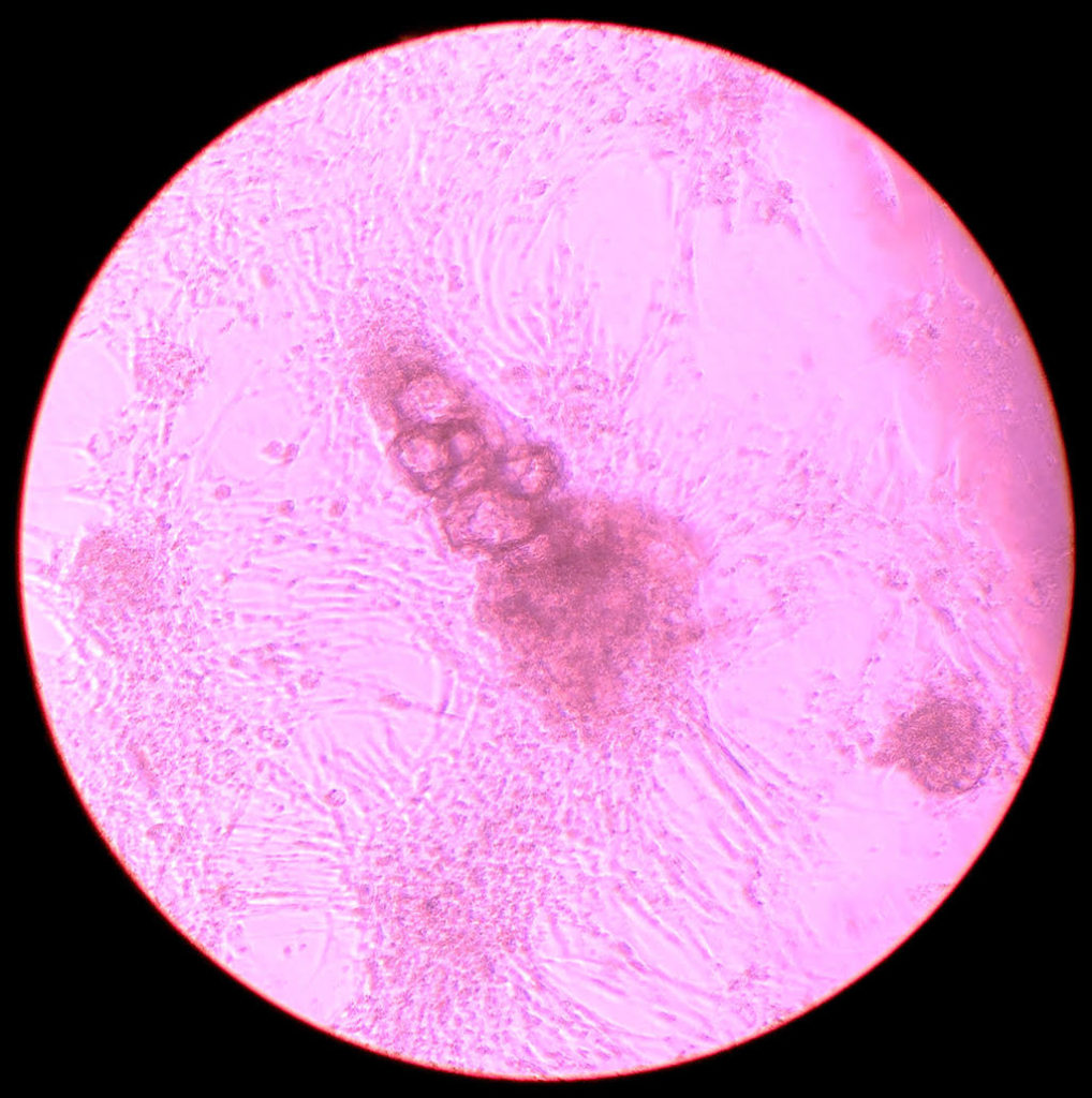How scientists are hijacking plant skeletons to make "clean meat" steaks